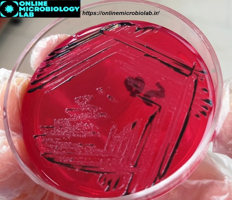 نمای کلنی ها روی محیط XLD آگار (Xylose Lysine Deoxycholate Agar ...