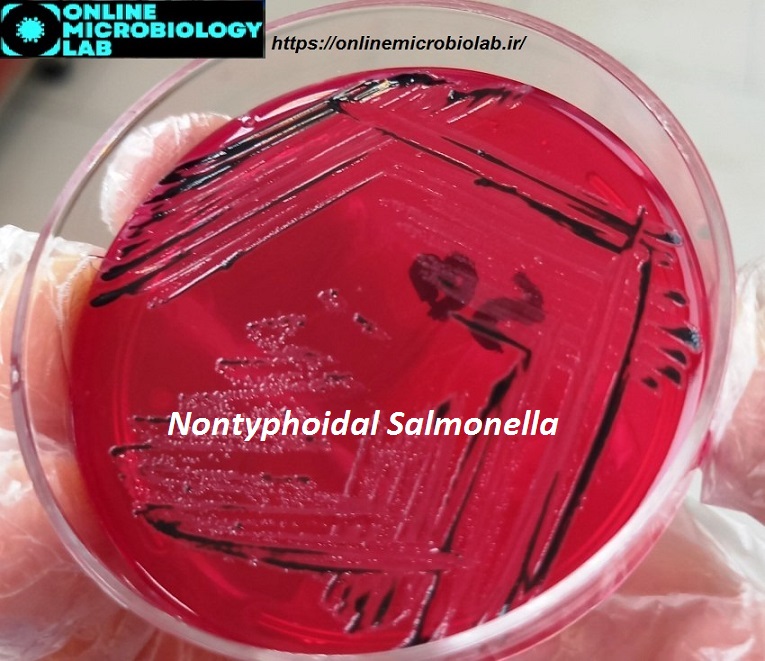 نمای کلنی ها روی محیط XLD آگار (Xylose Lysine Deoxycholate Agar ...