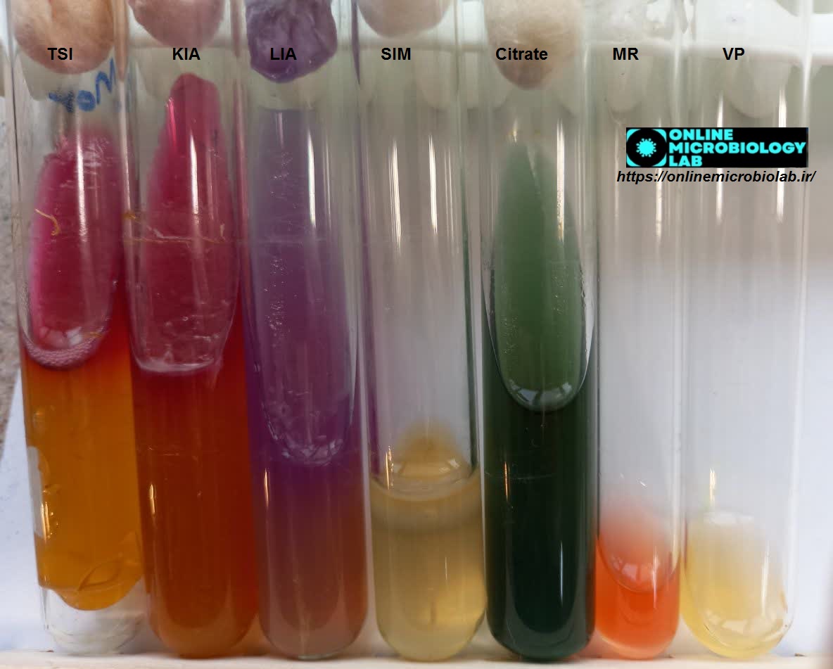 گالری مورگانلا مورگانی (Morganella morganii) - آزمایشگاه مجازی میکروب شناسی