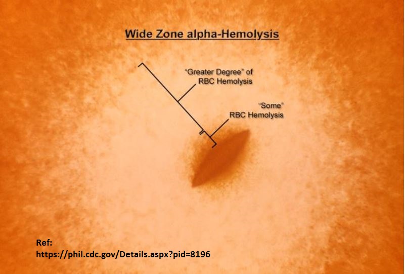 همولیز آلفا پرایم یا همولیز آلفا با ناحیه گسترده - آزمایشگاه مجازی ...