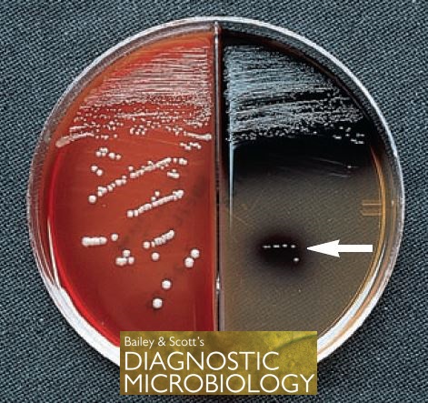 کلنی های باکتروئید فراژیلیس روی محیط BBE - آزمایشگاه مجازی میکروب شناسی