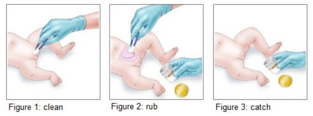 روش Clean-catch برای جمع آوری ادرار از نوزادن - آزمایشگاه مجازی میکروب ...