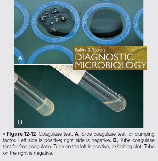 تست های کواگولاز (Coagulase Tests) - آزمایشگاه مجازی میکروب شناسی