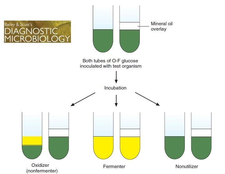تست OF یا Glucose oxidative-fermentation (O-F) test - آزمایشگاه مجازی ...