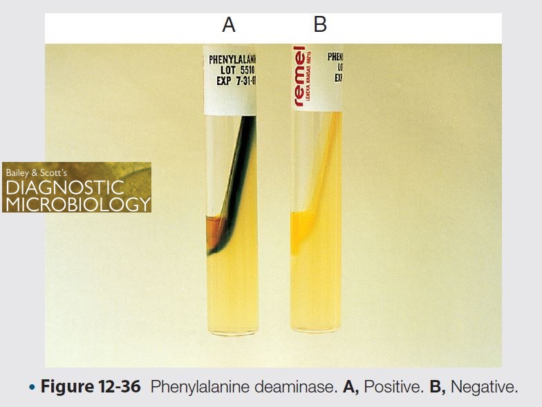 تست فنیل آلانین دآمیناز (Phenylalanine Deaminase Test) - آزمایشگاه ...