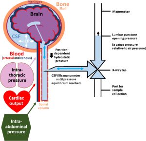 اندازه گیری مانومتر نخاعی در زمان نمونه گیری CSF - آزمایشگاه مجازی ...