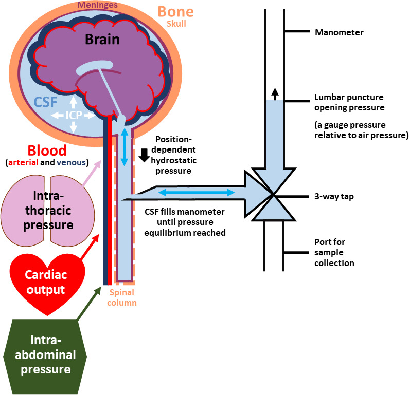 اندازه گیری مانومتر نخاعی در زمان نمونه گیری CSF - آزمایشگاه مجازی ...