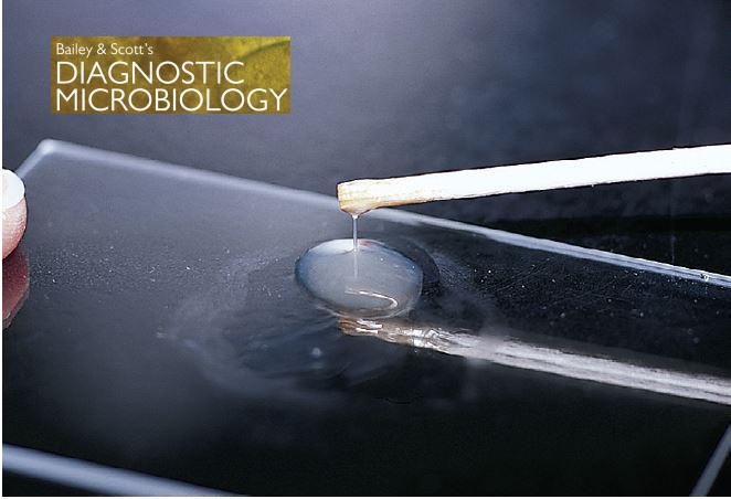 تست استرینگ (String) برای گونه های ویبریو - آزمایشگاه مجازی میکروب شناسی