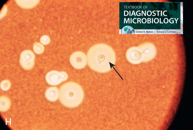 لام های قارچی رنگ آمیزی شده به روش جوهر هندی (India ink) - آزمایشگاه ...