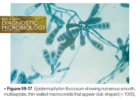 نمای میکروسکوپی اپیدرموفیتون فلوکوزوم (Epidermophyton floccosum ...
