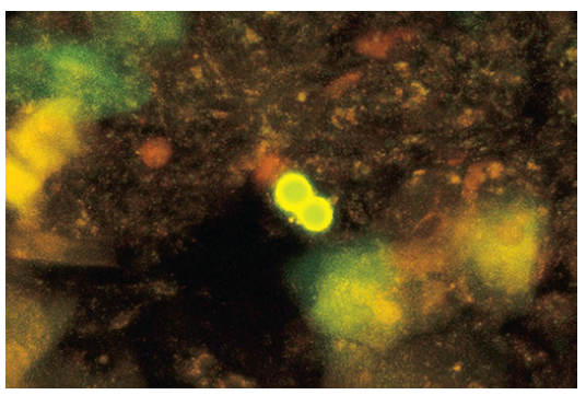 لام های قارچی رنگ شده به روش کالکوفلور سفید (Calcofluor white stain ...