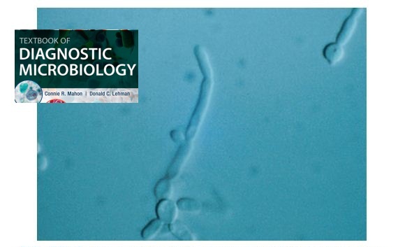 نمای میکروسکوپی جرم تیوب (Germ tube) یا لوله زایا در گونه های کاندیدا ...