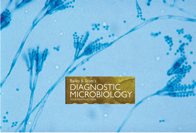 نمای میکروسکوپی گونه های پنی سیلیوم - آزمایشگاه مجازی میکروب شناسی