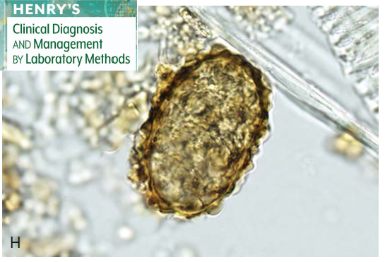 آسکاریس لومبریکوئیدس (Ascaris lumbricoides): چرخه زندگی و تشخیص ...