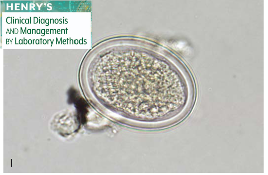 آسکاریس لومبریکوئیدس (Ascaris lumbricoides): چرخه زندگی و تشخیص ...