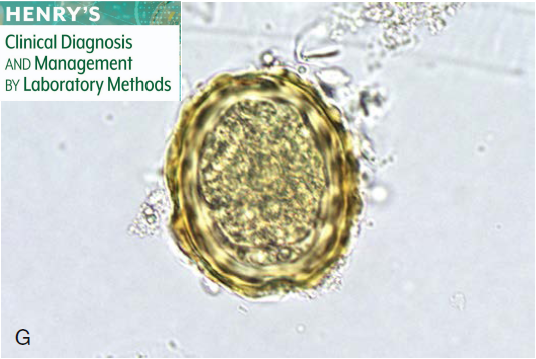 آسکاریس لومبریکوئیدس (Ascaris lumbricoides): چرخه زندگی و تشخیص ...