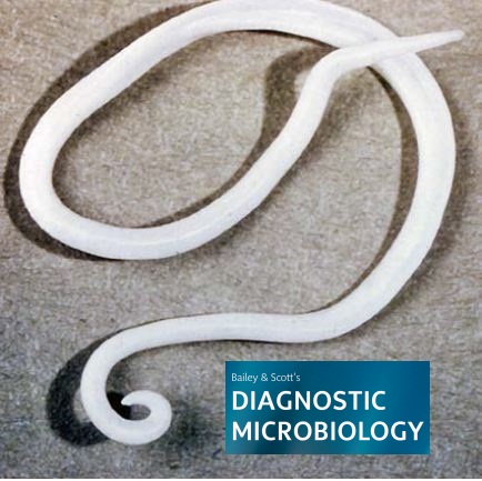 آسکاریس لومبریکوئیدس (Ascaris lumbricoides): چرخه زندگی و تشخیص ...