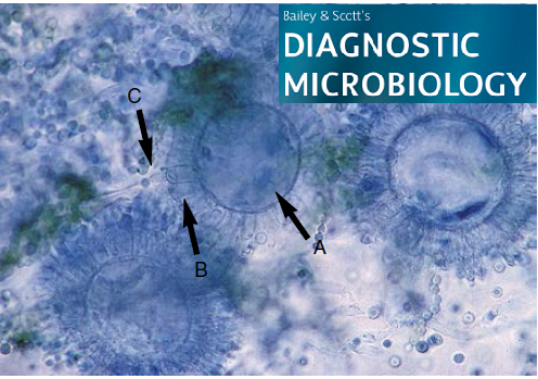 نمای میکروسکوپی و کلنی آسپرژیلوس فلاووس (A. flavus) - آزمایشگاه مجازی ...
