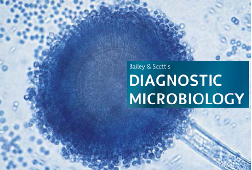 نمای میکروسکوپی آسپرژیلوس نیجر (A. niger) - آزمایشگاه مجازی میکروب شناسی
