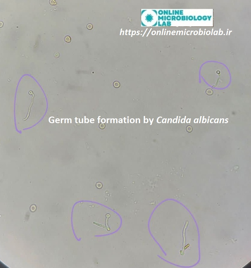 نمای میکروسکوپی جرم تیوب (Germ tube) یا لوله زایا در گونه های کاندیدا ...