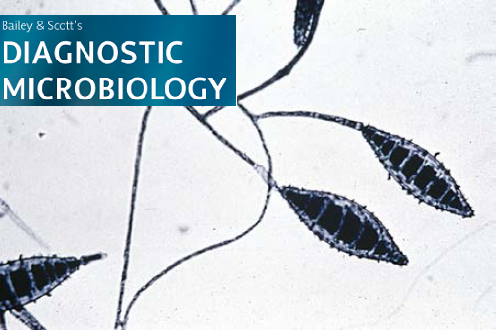 نمای میکروسکوپی و کلنی گونه های میکروسپوروم (Microsporum spp ...