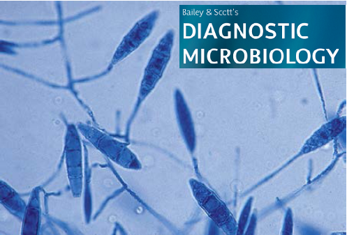 نمای میکروسکوپی و کلنی گونه های میکروسپوروم (Microsporum spp ...