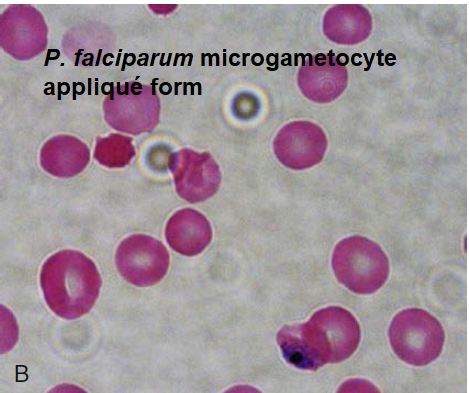 فرم های پلاسمودیوم فالسیپاروم (Plasmodium falciparum) - آزمایشگاه مجازی ...