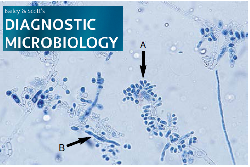 مقایسه نمای میکروسکوپی برخی گونه های تریکوفایتون (Trichophyton ...