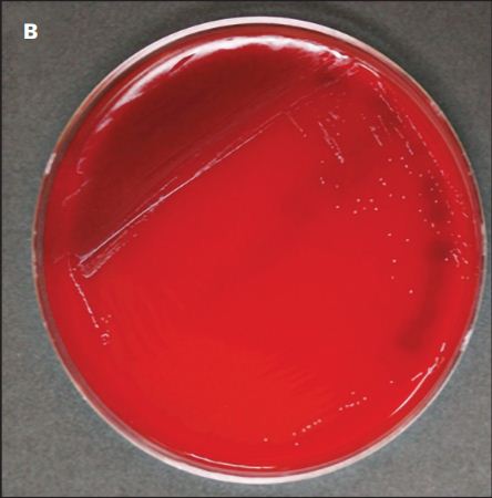 واریانت های کلنی کوچک (Small Colony Variants) استافیلوکوک اورئوس ...