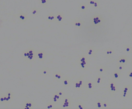 نمای کلنی و رنگ آمیزی گرم از آئروکوکوس یورینا (Aerococcus urinae) و ...