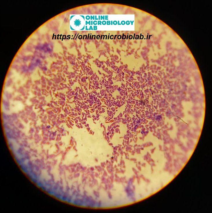 نمای میکروسکوپی از رنگ آمیزی گرم متغیر (Gram-variable staining ...