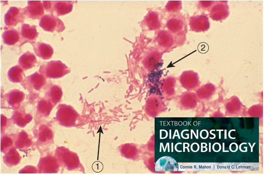 نمای میکروسکوپی از اسمیر مستقیم ادرار (Direct drop smear of urine ...