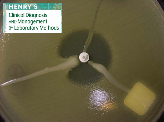 تست اصلاح‌شده هاج (Modified Hodge Test): جهت شناسایی سویه های تولید ...