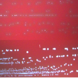 نمای کلنی و رنگ آمیزی گرم از آئروکوکوس یورینا (Aerococcus urinae) و ...