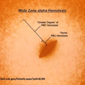 همولیز آلفا پرایم یا همولیز آلفا با ناحیه گسترده - آزمایشگاه مجازی ...