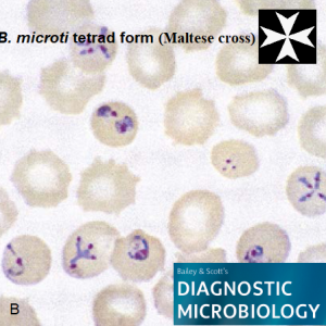 بابزیا (Babesia): چرخه زندگی و تشخیص - آزمایشگاه مجازی میکروب شناسی