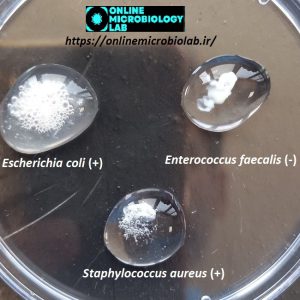 تست کاتالاز (روش اسلایدی) - (Catalase Test -Slide Method) - آزمایشگاه ...