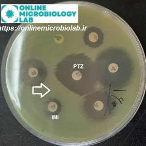 تست D-Zone برای سودوموناس آئروژینوزا - آزمایشگاه مجازی میکروب شناسی