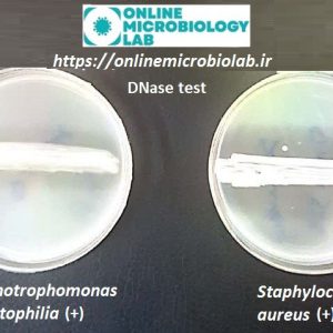 واکنش های بیوشیمیایی استنوتروفوموناس مالتوفیلیا - آزمایشگاه مجازی ...