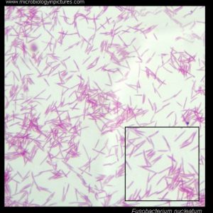 نمای میکروسکوپی Fusobacterium nucleatum - آزمایشگاه مجازی میکروب شناسی