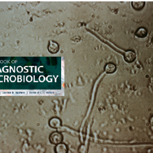 نمای میکروسکوپی جرم تیوب (Germ tube) یا لوله زایا در گونه های کاندیدا ...