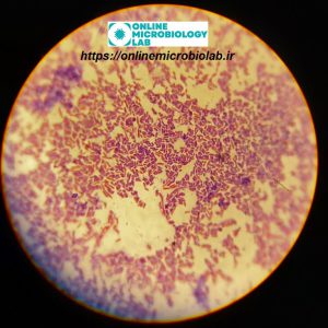 نمای میکروسکوپی از رنگ آمیزی گرم متغیر (Gram-variable staining ...