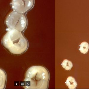 کلنی شبیه دندان مولر گونه های اکتینومایست - آزمایشگاه مجازی میکروب شناسی