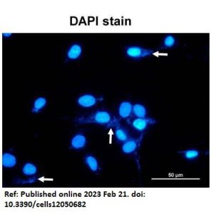 نمای میکروسکوپی مایکوپلاسما با رنگ آمیزی DAPI - آزمایشگاه مجازی میکروب ...