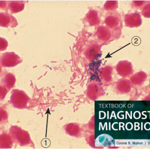 نمای میکروسکوپی از اسمیر مستقیم ادرار (Direct drop smear of urine ...